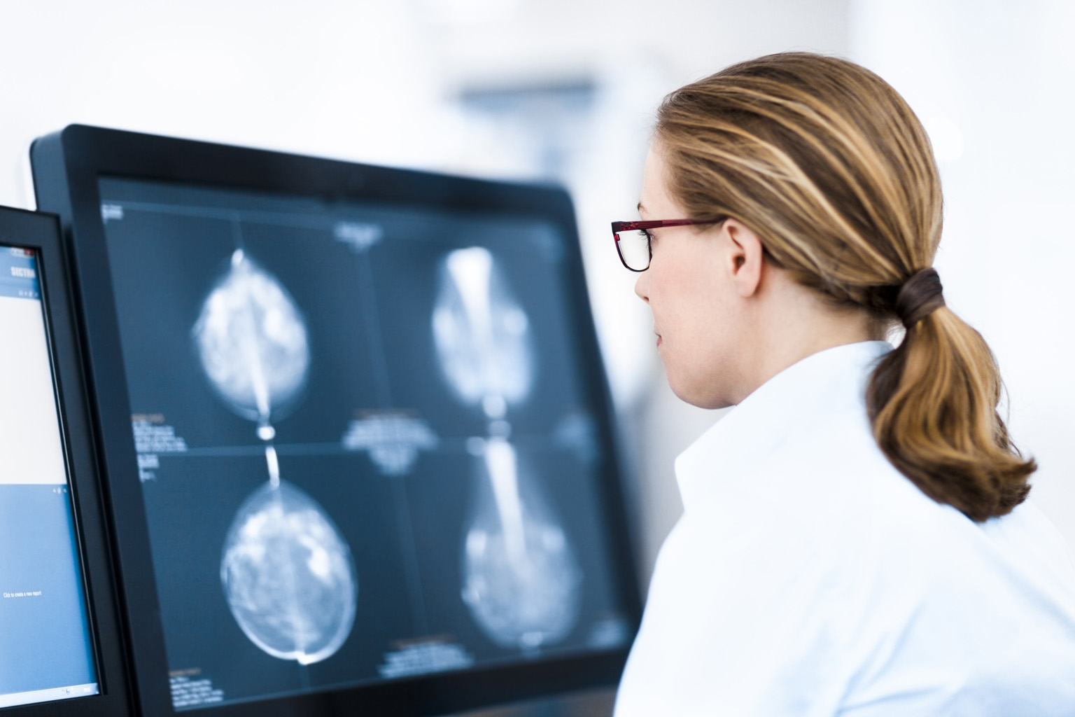 IDS7 Display Protocollen | Sectra Global E-learning